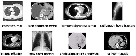 A New Generative Model For Textual Descriptions Of Medical Images Using Transformers Enhanced