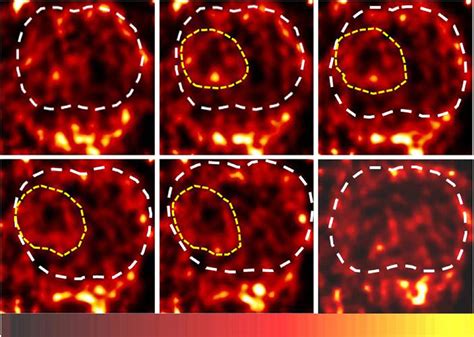 Figure 1 From Imaging Of Rat Cerebral Ischemia Reperfusion Injury Using