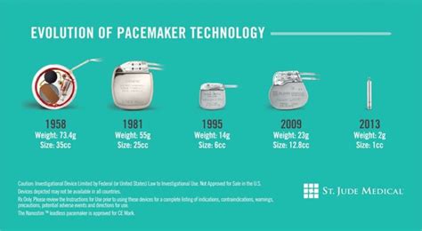 Una Possibile Nuova Frontiera Dellaritmologia Il Pacemaker Senza Fili