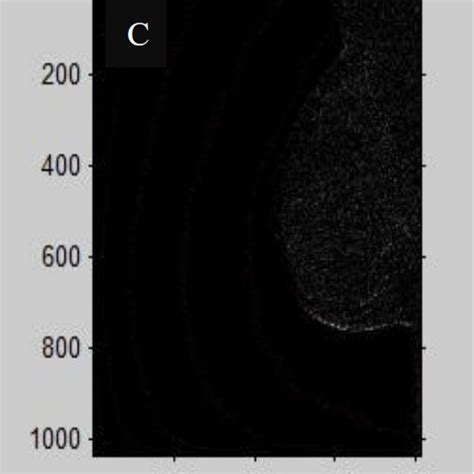 First Level Db4 Wavelet Decomposition A Original Mammography Image