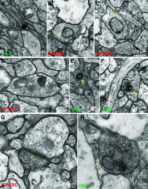 Presence Of Multiple Organelles Of The Endolysosomal System In Axon Download Scientific Diagram