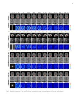 A Unifying Multi Sampling Ratio CS MRI Framework With Two Grid Cycle Correction And Geometric