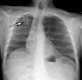 3 Chest Radiology Key