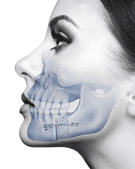Maxillofacial Surgery Maxillofacial Surgeon At Harley Street