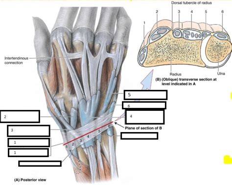 Dorsal Tubercle Of Radius Wrist Block Landmarks And Nerve Stimulator