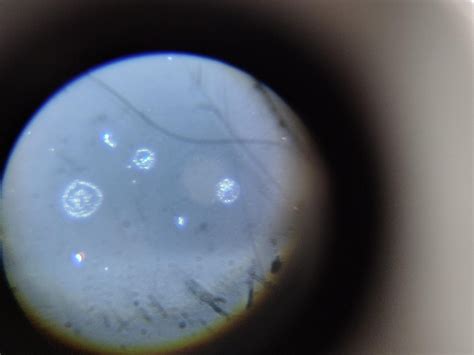 Parasite Egg Identification 160x Parasitology