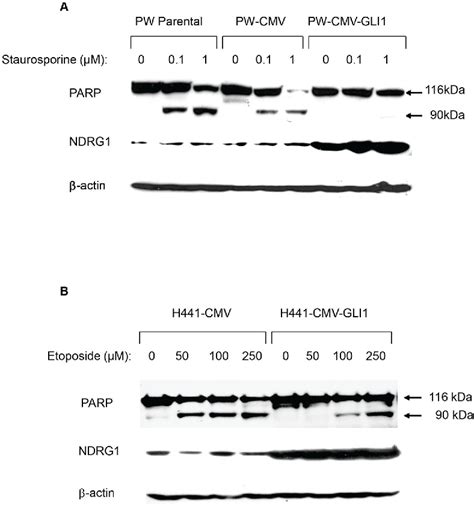 figure 1 from role of gli1 and ndrg1 in increased resistance to