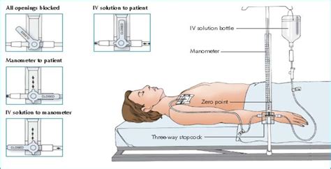 Cvp Measurement Darmanx Academy