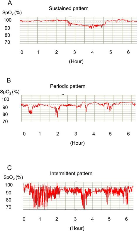 Characteristics Of The Nocturnal Waveform Pattern Of Spo2 In Copd