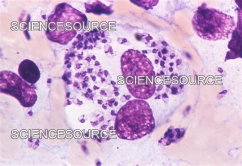 Visceral Leishmaniasis Under A Microsc Stock Image Science Source Images