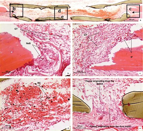 Photomicrographs Of A Perforated Membrane Treated Specimen From The