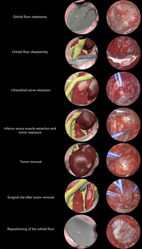 Seven Phase Procedure Is Shown By Associating Virtual And Real