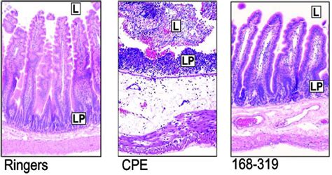 Figure 1 From The Interaction Of Clostridium Perfringens Enterotoxin