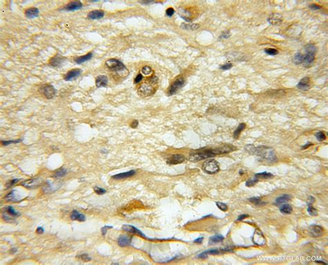 Usp33 Antibody 12060 2 Ap Proteintech