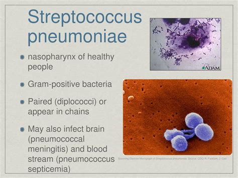 Ppt Streptococcus Pneumoniae Powerpoint Presentation Free Download Id6601980