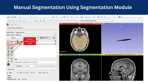 How To Segment With 3d Slicer Manual Semi Automatic And Automatic Techniques Machine Mindscape