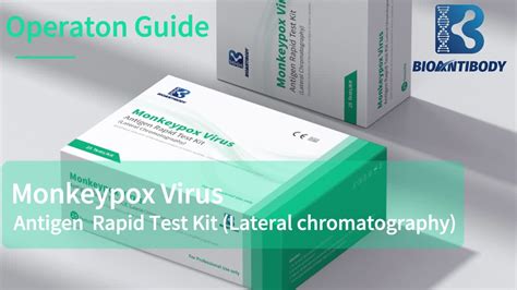 Monkeypox Diagnostic Test Kits For Public Health Biotechnology