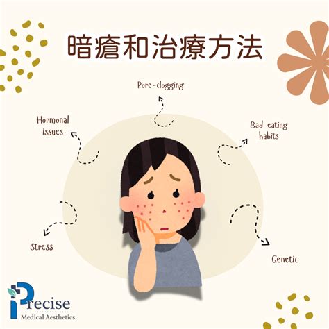 暗瘡和治療方法 Precise Medical Aesthetics