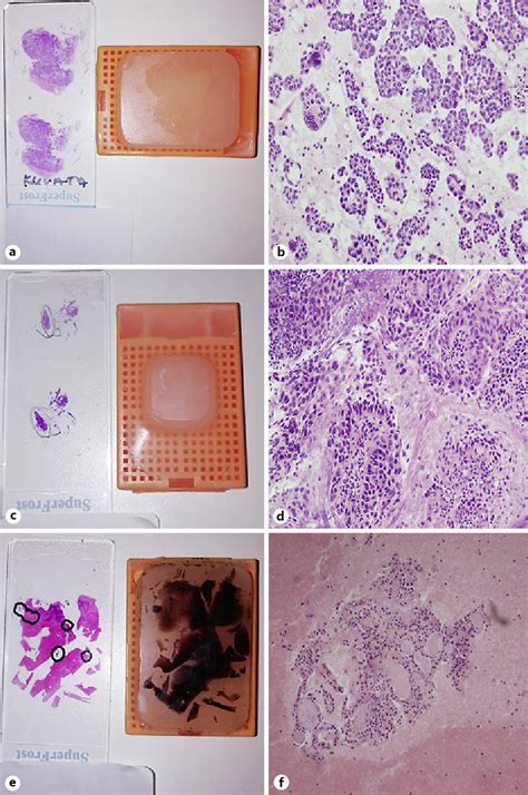 Figure 1 From New Cell Block Method To Enhance The Cellular Yield In