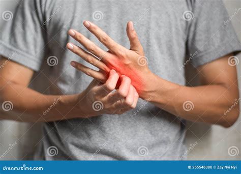 Asian Man Scratching His Hand Concept Of Itchy Skin Diseases Such As