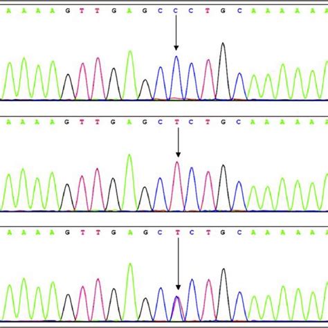 Sequencing Map For Genotypes Of Pin1 Gene Rs2233678 Polymorphism In Download Scientific Diagram