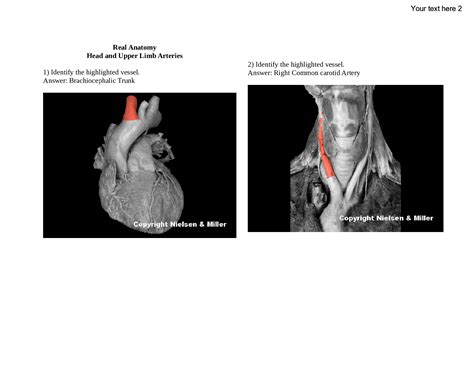 Lab Assignment Heart Arteries Veins Ekg At Glen Williams Blog