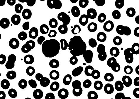 Python Opencv Image Processing Dilution Intersection Complement