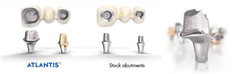 Atlantis Implant Abutments Preferred Dental Laboratory