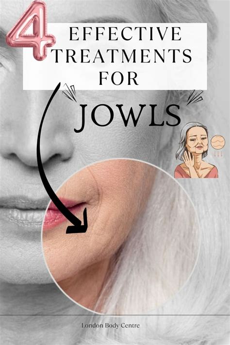 Comprehensive Guide To 4 Effective Treatments For Jowls In Aesthetics