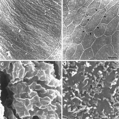 Apical Cell Surface Morphology Of Normal A And C And Upiii Deficient