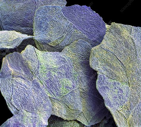 Skin Cells Sem Stock Image F043 1024 Science Photo Library