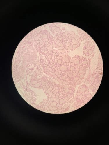 Bio 224 Lab Exam 1 Endocrine Lymphatic Flashcards Quizlet