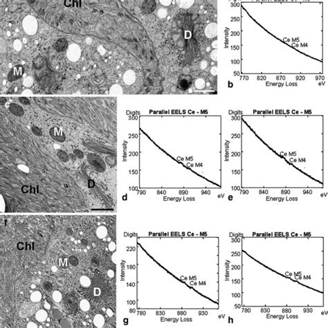 Tem Micrographs Showing The Ultrastructure Of Micrasterias Cells