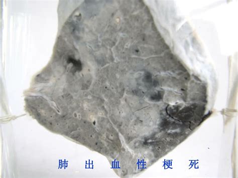 Ppt 实验四 局部血液循环障碍（二 ） Powerpoint Presentation Id6185503