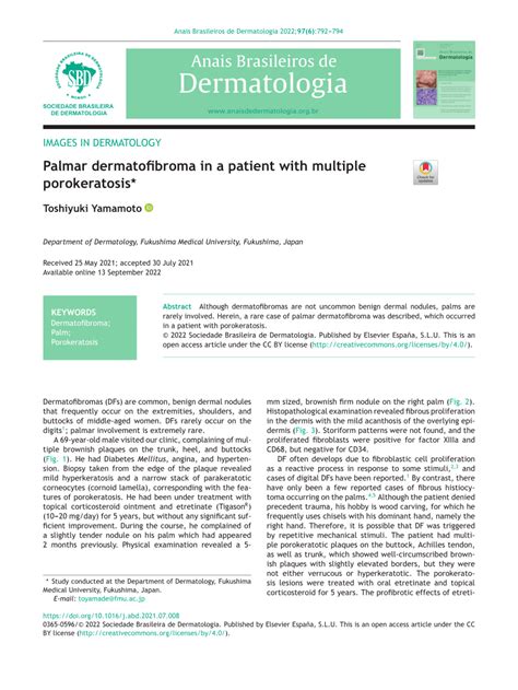 Pdf Palmar Dermatofibroma In A Patient With Multiple Porokeratosis