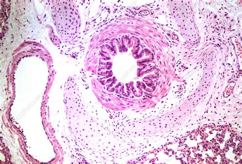 Lm Of A Cross Section Through A Bronchiole In Lung Stock Image P590 0175 Science Photo Library