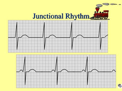 Ppt Name That Rhythm Powerpoint Presentation Free Download Id3210511