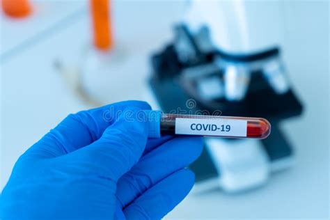 Tubo De Ensaio Com Amostra De Sangue Infectada Pela Gripe Testada No