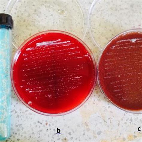 Afb Staining Partially Acid Fast Branching Rod Suggestive Nocardia Download Scientific Diagram