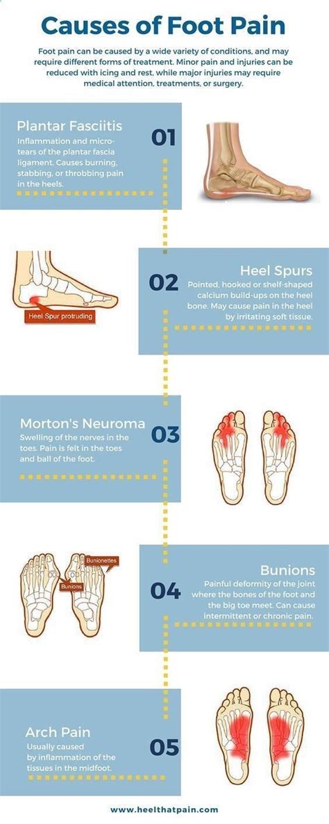Plantar Fasciitis Trigger Points Iron Garden Decor