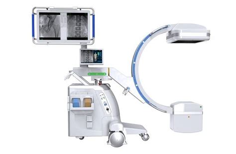 Strategies And Methods For Reducing X Ray Radiation Perlove
