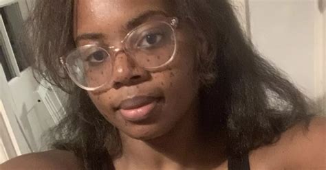 Woman Who Has Trouble Breathing As Breasts Are So Big Has To Pay For