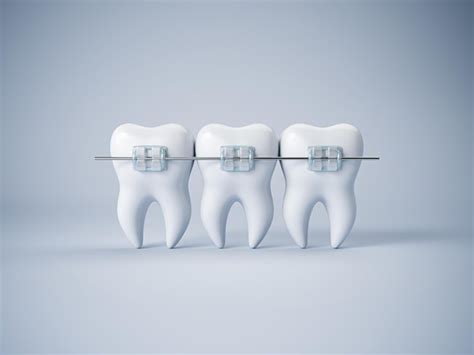 Premium Photo Teeth With Or Without Braces Arch Braces Without Teeth Orthodontic Dentistry The