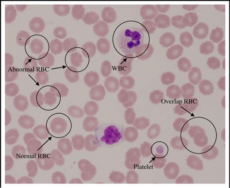 Figure 310 From Analysis Of Red Blood Cell Rbc Classification Using