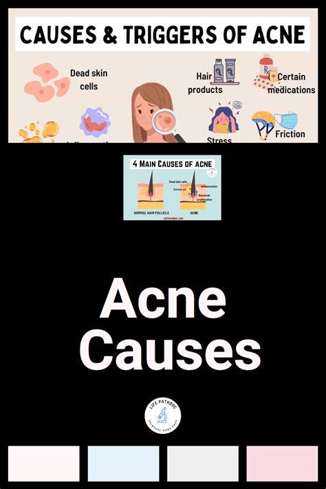 Acne Inversus Artofit
