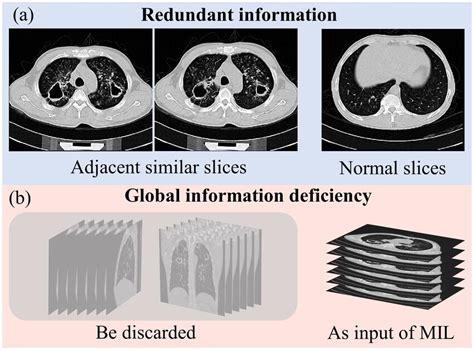 Two Issues Of Mil Based Works In Ct Volume Classification Tasks A