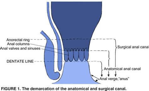 Human Papilloma Virus And Squamous Cell Carcinoma Of The Anus Cancer Therapy Advisor