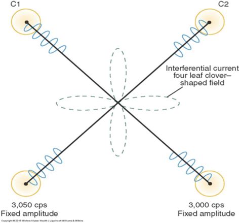 Interferential Currents Ifc Flashcards Quizlet