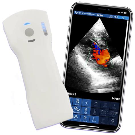 8 Best Portable Echo Ultrasound Machines For Cardiac Care