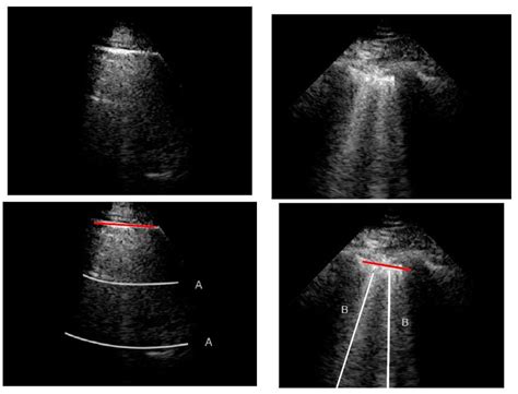Computational Ultrasound Imaging Visual Information Laboratory